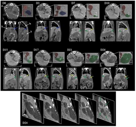 Micro Ct Imaging Of Tumor Bearing Mice After Intrahepatic Injection Of