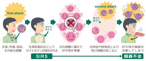 Sirsの診断基準｜知っておきたい臨床で使う指標 7 看護roo カンゴルー
