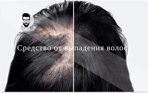 Лучшее средство от выпадения волос