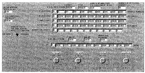 R Waves Detection Results And Hr Estimation Download Scientific Diagram