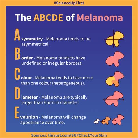 The Abcde Of Melanoma Scienceupfirst