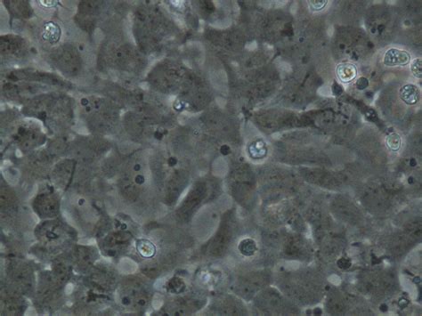 Regenerative Medicine An Emerging U Of U Research Collective