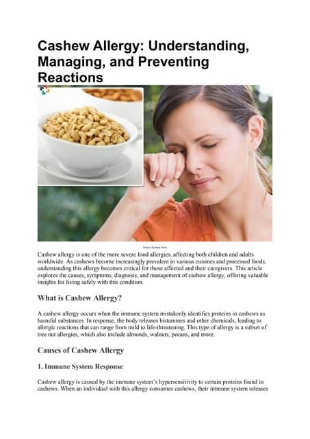 Cashew Allergy Causes Symptoms Preventions And Diagnosing The