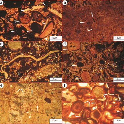 Photomicrographs Showing Observed Skeletal And Non Skeletal Components Download Scientific