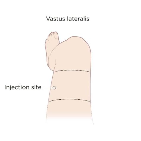 Intramuscular Vs Subcutaneous Testosterone Replacement Therapy Trt Pros And Cons Comfort In