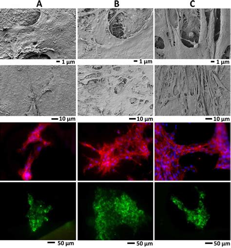 Sem Micrographs Upper Two Rows Of St 2 Cells Growing On Pclcsκ C