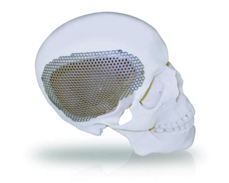 BONEMASTER 製品情報詳細 パイオラックスメディカルデバイス