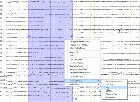 Brain Products Tricks And Tips In Brainvision Analyzer 2 Part Ii
