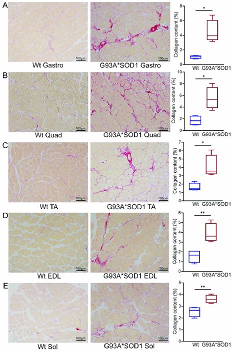 Increased Collagen Deposition In The Skeletal Muscles Of G93a Sod1