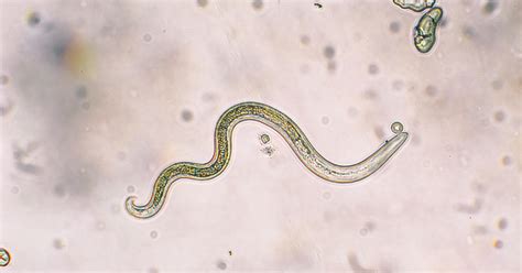 Doctor In The House Parasites In Your Body I3investor