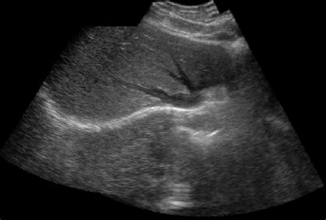 A C 3d Feature Point Matching In Phantom And Clinical Data