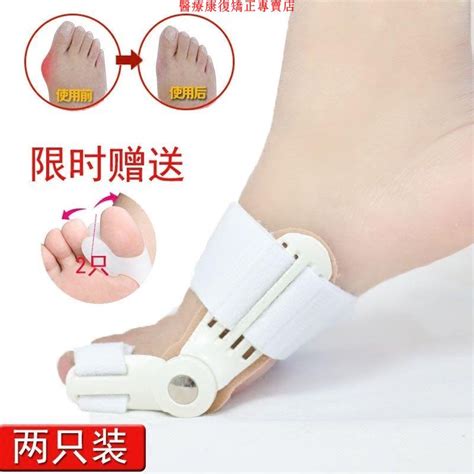 台灣桃園保固醫療康復矯正專賣店大拇指外翻矯正器成人男女大腳骨腳趾矯正器重疊趾拇外翻分趾器 蝦皮購物
