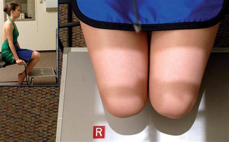 Ch 6 Projections Patella And Intercondylar Sulcus Flashcards Quizlet
