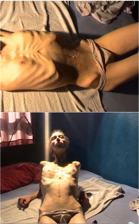 Extremely Skinny And Anorexic Softcore Posing Women Videos