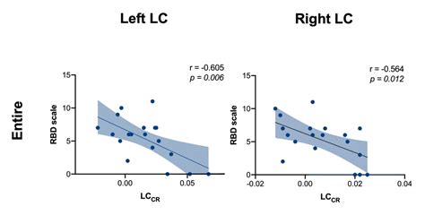 Neurogenic Orthostatic Hypotension In Parkinsons Disease Is There A