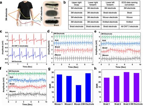 Electrocardiogram Sensing Performance Of Cnt Textile Electrodes A Download Scientific Diagram
