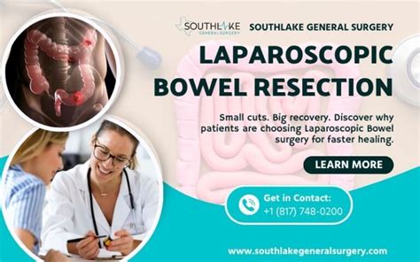 Laparoscopic Bowel Resection Your Recovery Guide Southlake General Surgery