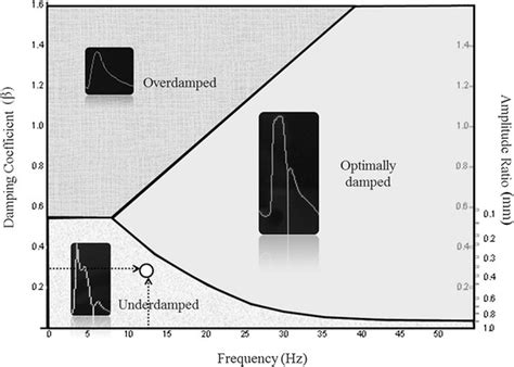 Diagram Showing The Three Areas For Underdamped Overdamped And