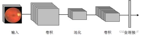 毕业设计：基于深度学习的视网膜图像分割算法实现 视网膜分割算法 csdn博客