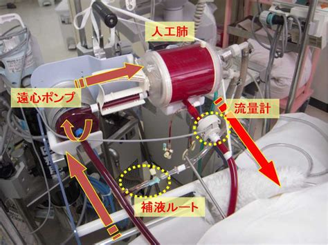 【臨床工学技士科】ecmo（エクモ）についてご紹介します！