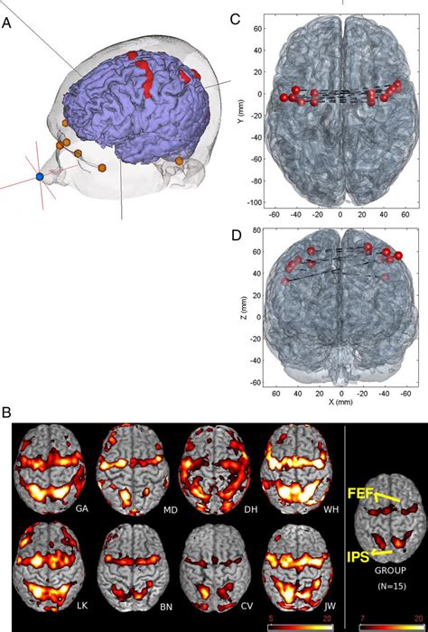 A 3 Dimensional 3d Rendering Of The Skin And Segmented Gray Matter Download Scientific