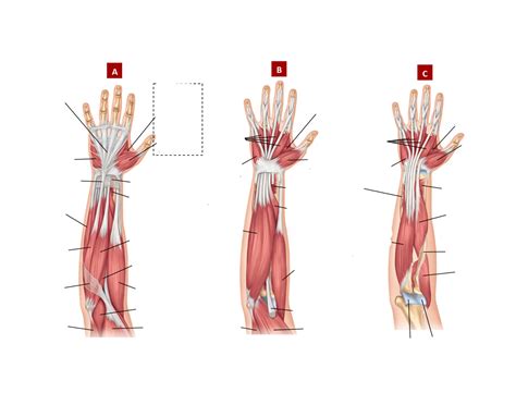 Right Flexor Forearm Muscles Quiz