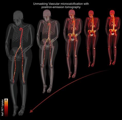Kivork Baghdasarian On Linkedin Spatial Atlas For Mapping Vascular