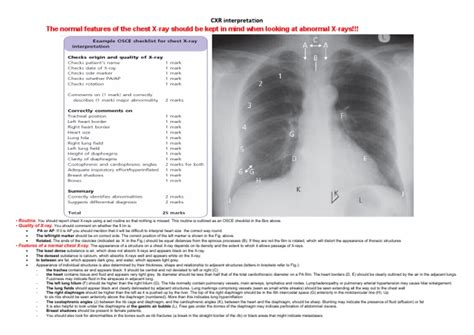 Cxr Interpretation Checklist Short Pdf Lung Thorax Cxr Interpretation Checklist Short Pdf Lung Thorax