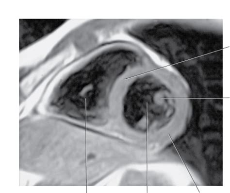 Ventricles Diagram Quizlet