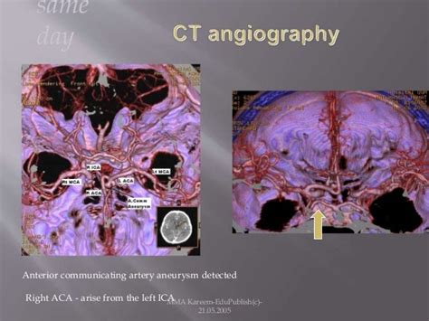 Clinical Application Of Helical Ct Scan In Husm Edu Publish Mma Kareem