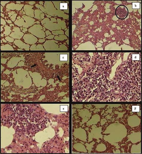 The Histopathological Studies Of Lung Sections Viewed Under A Light