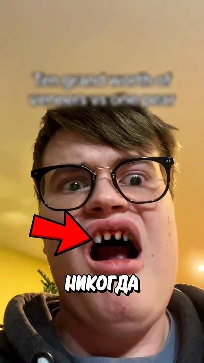 Опасные Острые Зубы 😱 Youtube