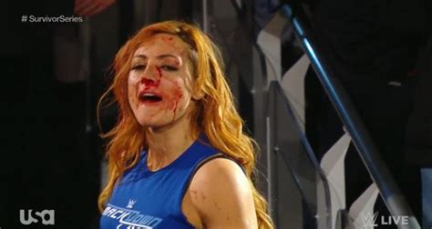 Becky Lynch Busted Open On Wwe Raw Before Survivor Series