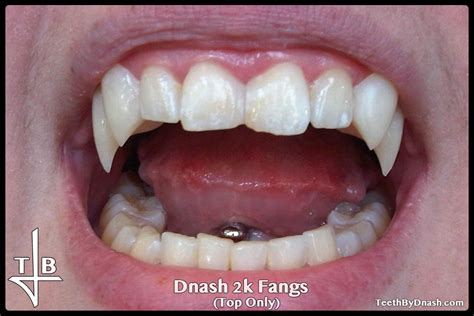 Dnash Teeth By Dnash