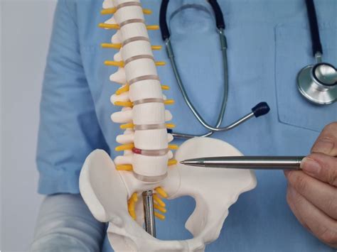 Coflex A Minimally Invasive Alternative To Spinal Fusion