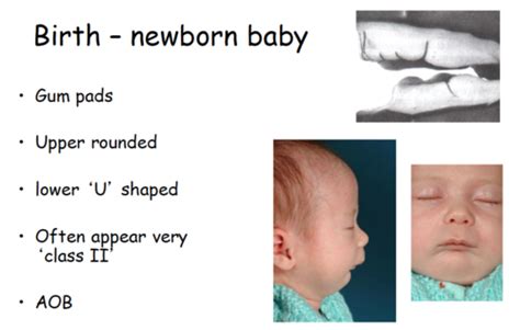 Tooth Eruption And Normal Dental Development Flashcards Quizlet