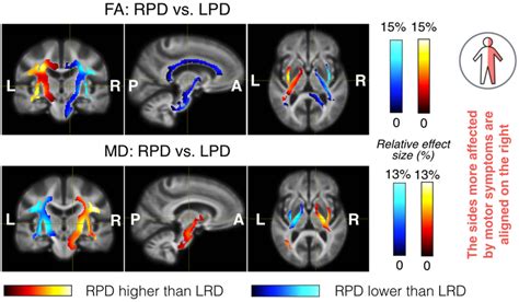 comparison of fractional anisotropy fa and mean diffusivity md