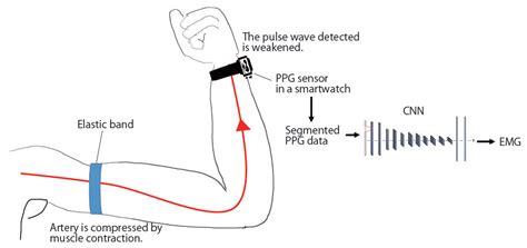 Sensors Free Full Text Ppg2emg Estimating Upper Arm Muscle Activities And Emg From Wrist