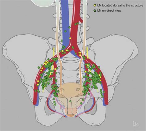 Current Status Of Lymph Node Imaging In Bladder And Prostate Cancer