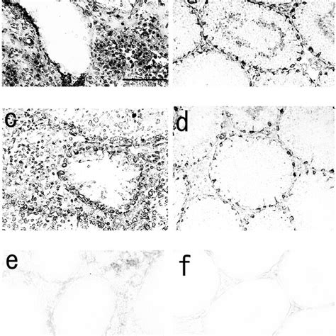 Immunohistochemical Staining Of Ifn γ And Tnf α In Eao Affected And Download Scientific Diagram