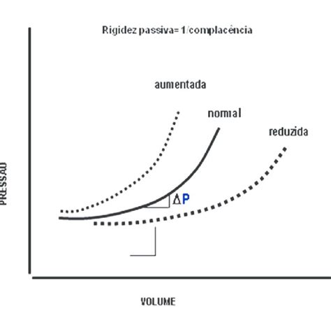 Representação esquemática de alças pressão volume do ventrículo