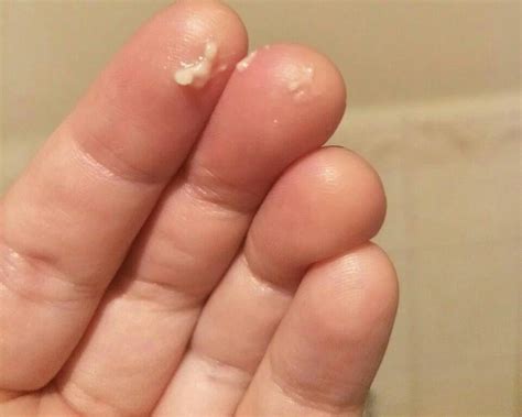 What Does A Lot Of Cervical Mucus Mean At Sergio Hasting Blog