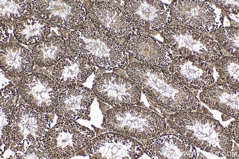 Polr2d Antibody 16093 1 Ap Proteintech