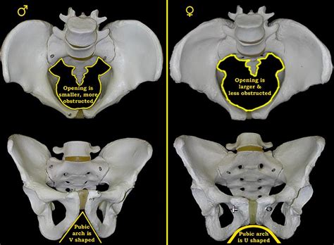 The Differences Between The Male And Female Pelvis RADIOLOGYPICS COM