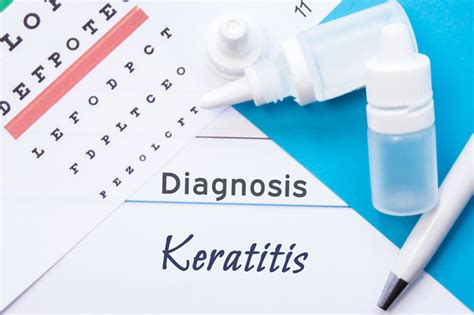 Keratitis Causes Symptoms And Treatment