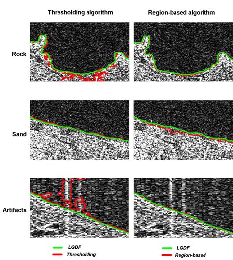 Segmentation Results Using Thresholding Region Based Algorithm And