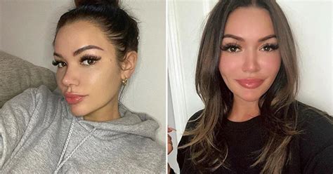 Surgery Genesis Lopez Complete Photos And Video Media 803