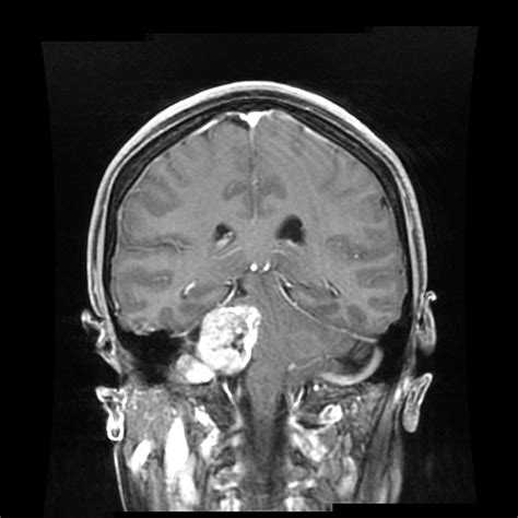 Mri Sequence Names At Laurence Drake Blog