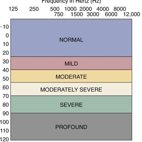 The Peripheral Auditory System Can Be Divided Into Three Parts The