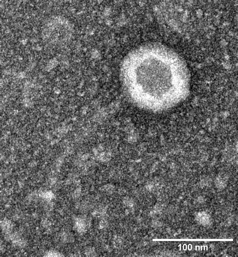 The Actinobacteriophage Database Phage Issa7
